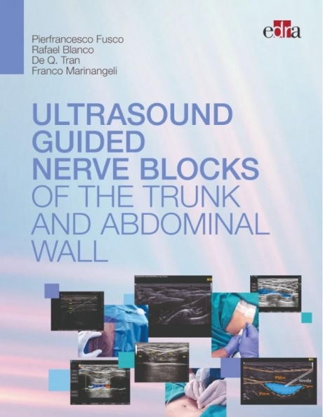 MEDICAL : Ultrasound Guided Nerve Blocks of the Trunk and Abdominal ...